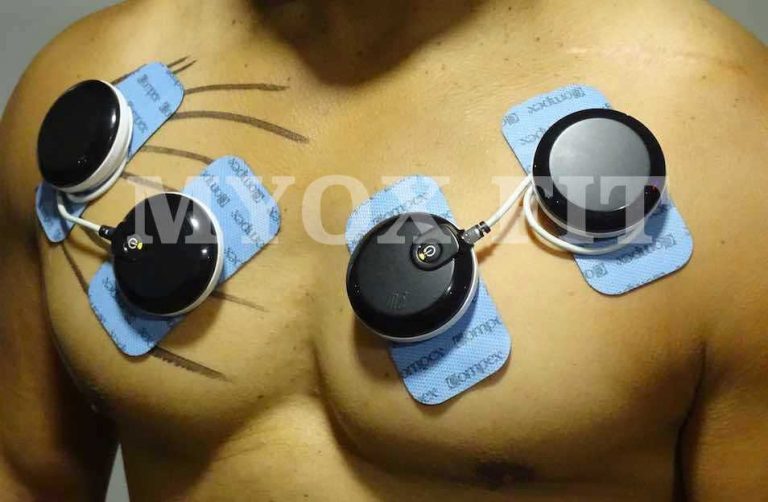 Colocação dos eletrodos no peitoral com Compex - Myox.fit